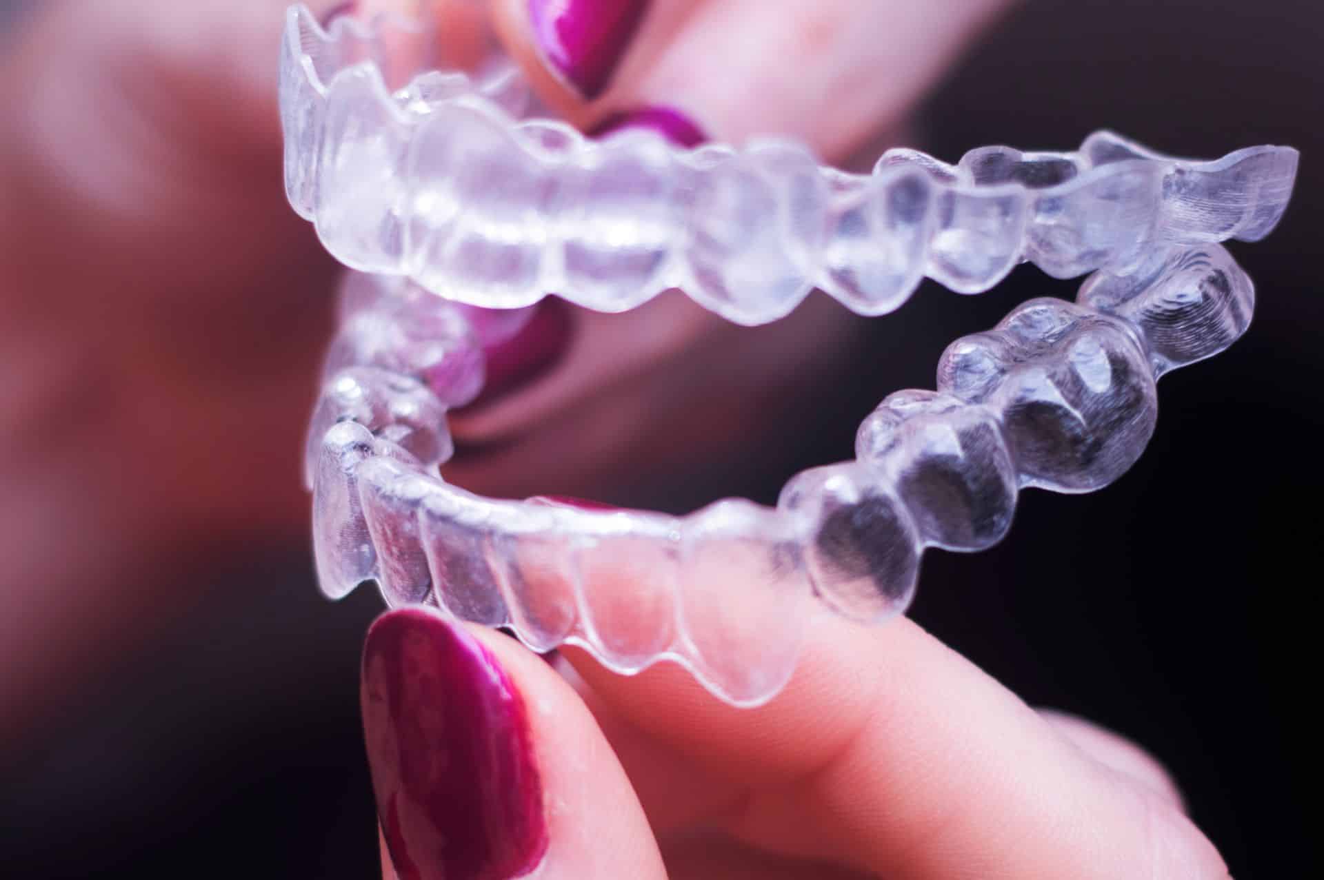 Διαφανείς Νάρθηκες (Aligners): Αισθητική Ορθοδοντική